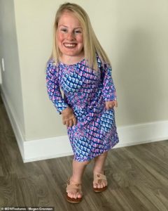 On se moquait d'elle parce qu'elle souffrait d'une forme rare de ...